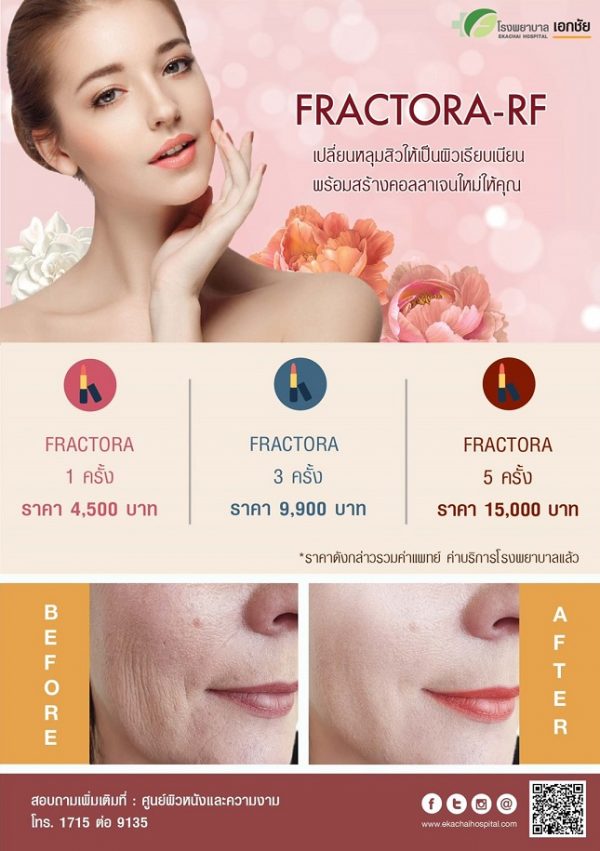 FRACTORA-RF | โรงพยาบาลเอกชัย